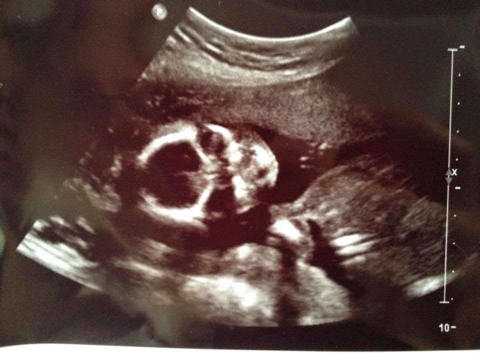 19 weeks - Ultrasound & Gender Reveal TOMORROW!!