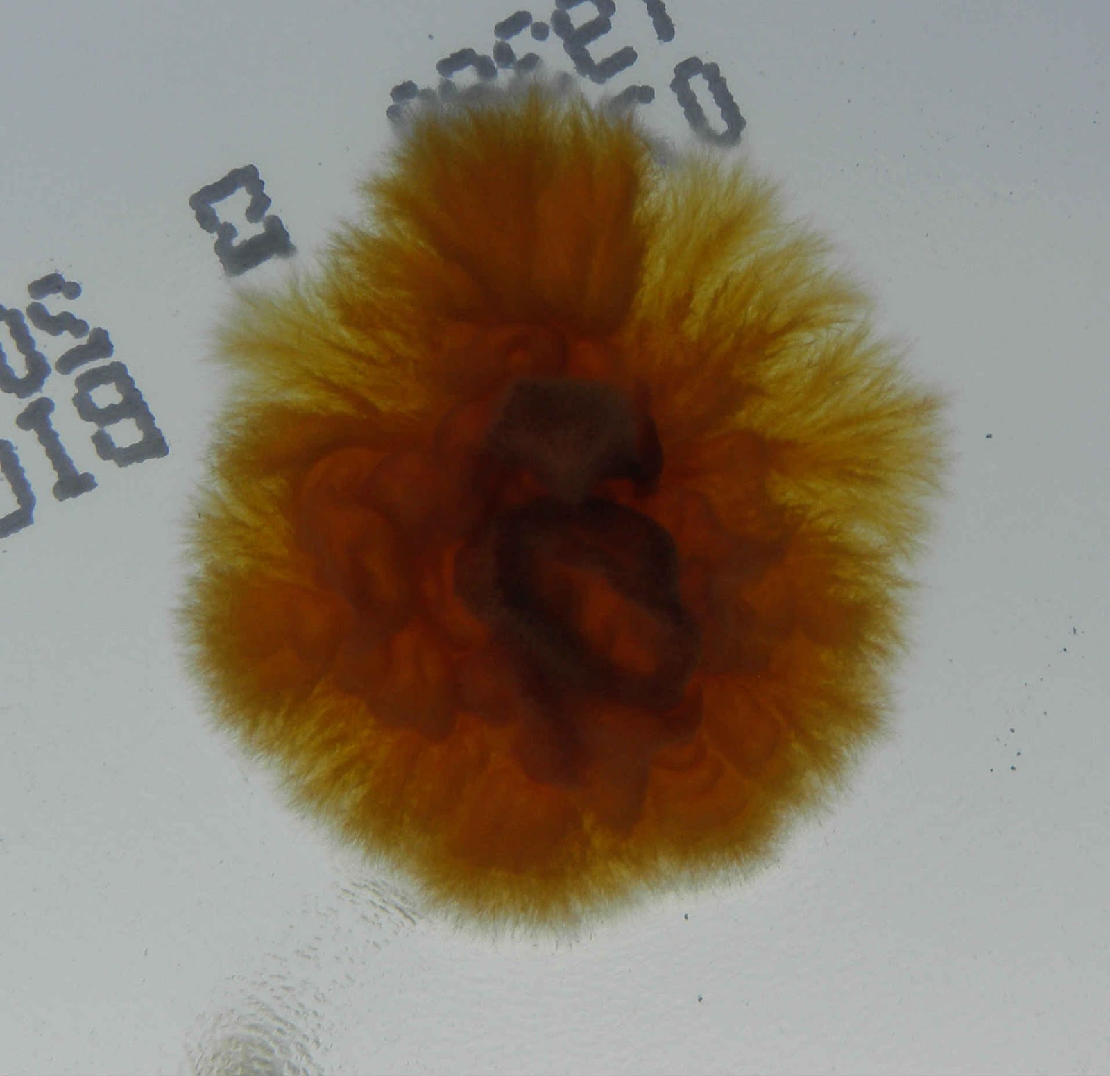 ATLAS MICOLOGIA: TRICHOPHYTON SOUDANENSE