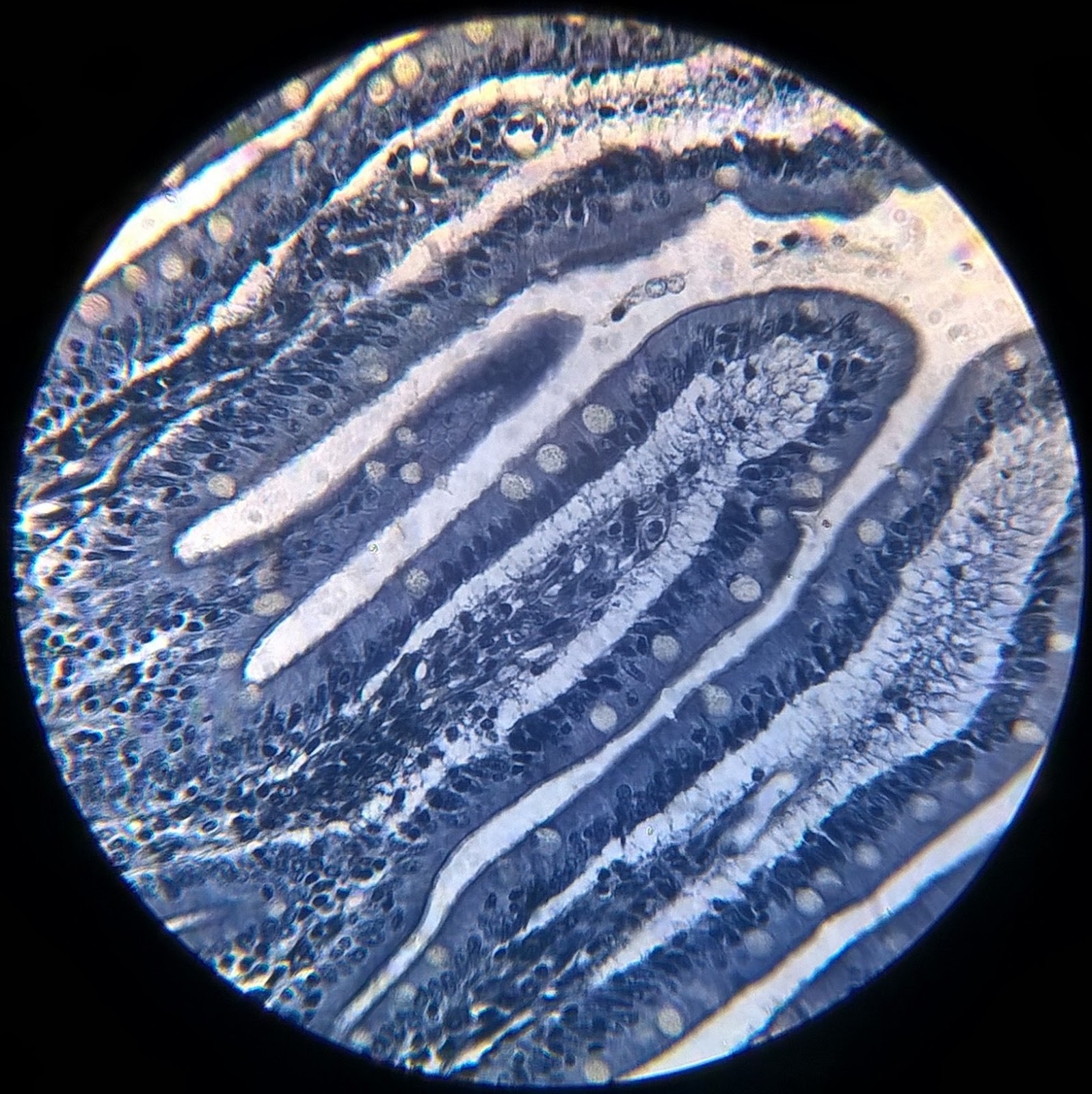 Backspace does not erase: Fastening the iris screws