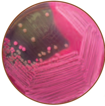 [Microbiology] MacConkey Agar | Free Medical Atlas