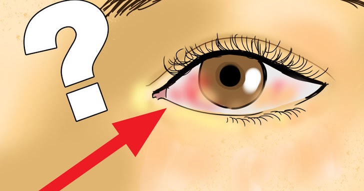 Sports et Santé: 08 Choses que vos yeux peuvent vous dire à propos de ...