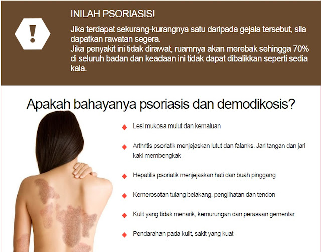 Rawat Sakit Kulit Psoriasis dan Sakit Kulit Lain Dengan Tanah Liat dan ...