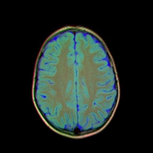 Nevit's blog: Color MRI of the Brain