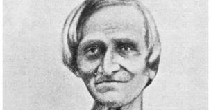 Alexis St. Martin, el hombre con un agujero en el cuerpo que le ...