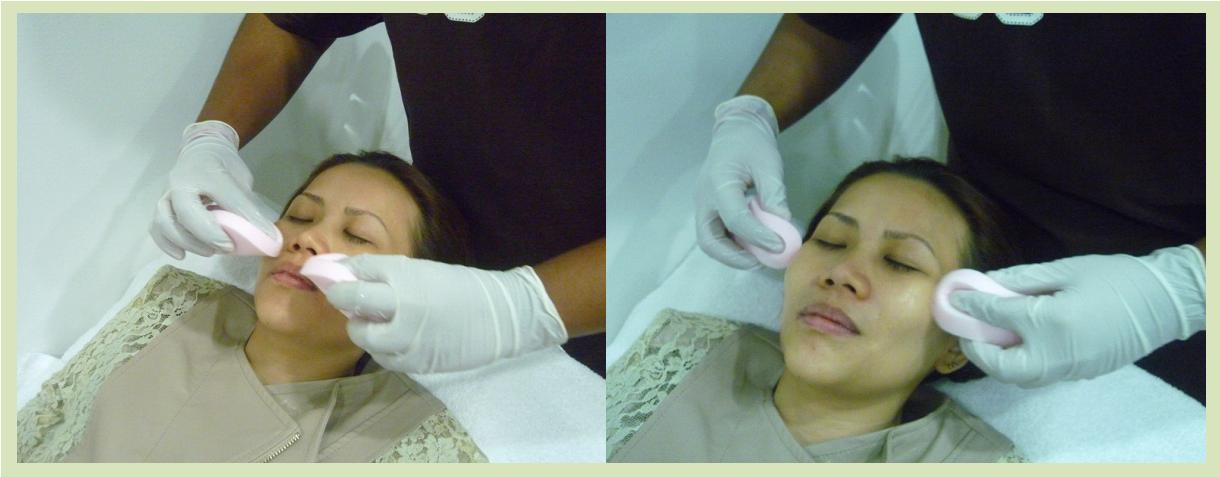 EVERGREEN LOVE: Clique Clinic - Tranexamic Acid Injection (Scar)