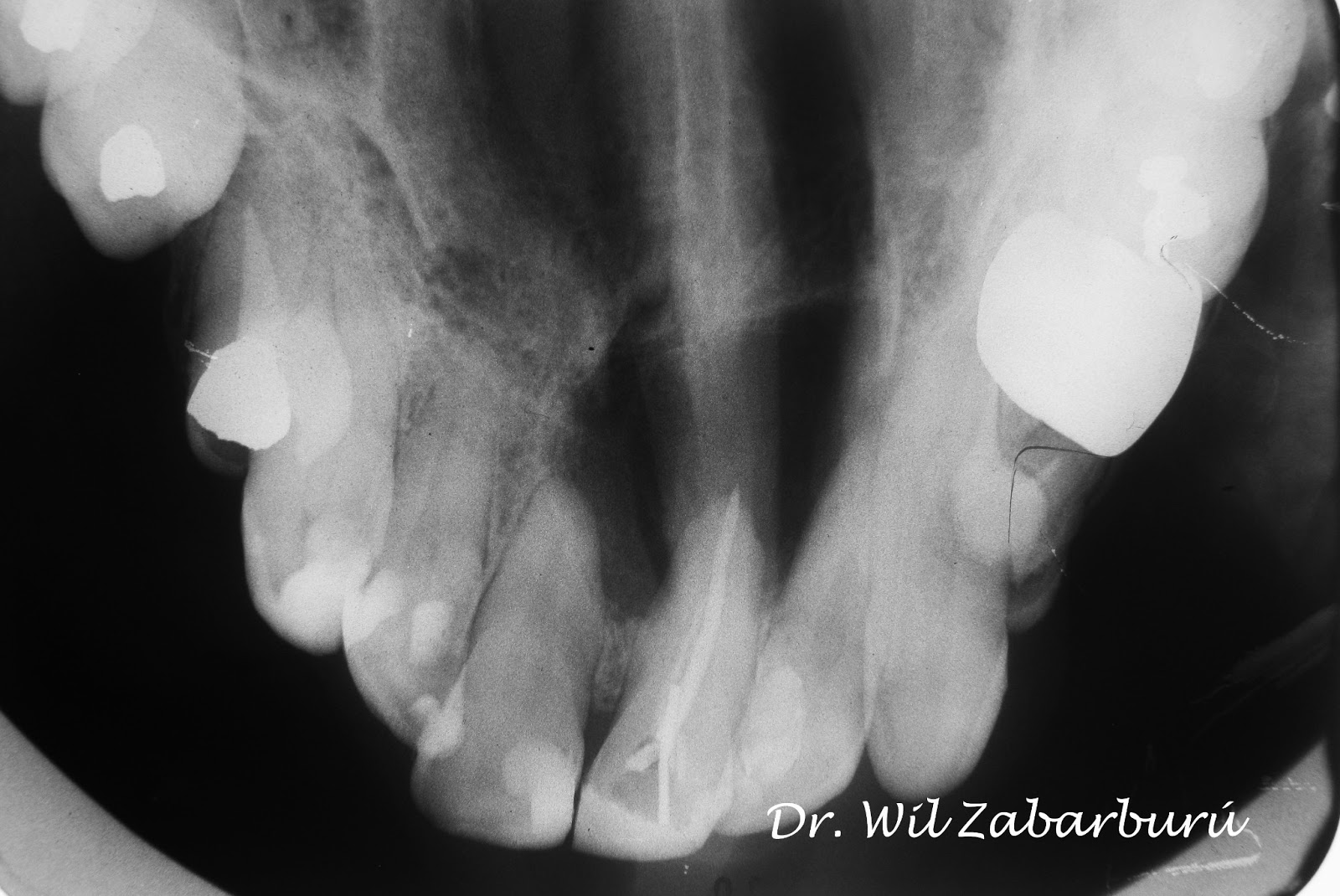 CLINICA DENTAL ASISTENCIAL: CIRUGÍA PERIAPICAL