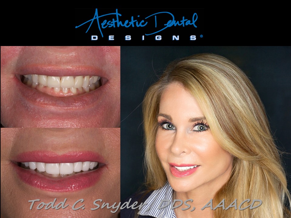 Aesthetic Dental Designs