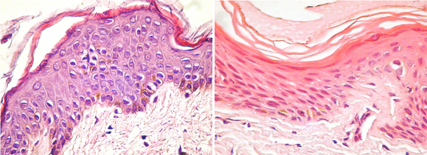 Granular Layer , Cornified Layer & The Regulation of Epidermal ...