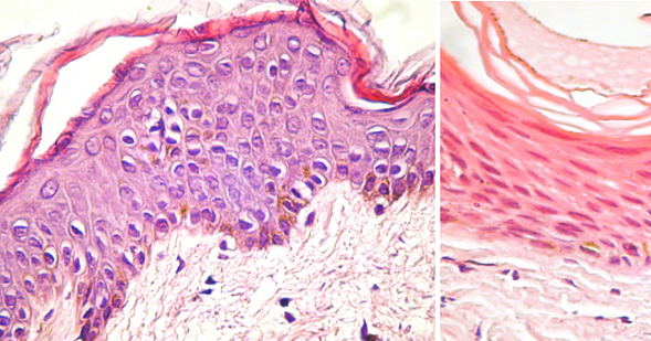 Granular Layer , Cornified Layer & The Regulation of Epidermal ...
