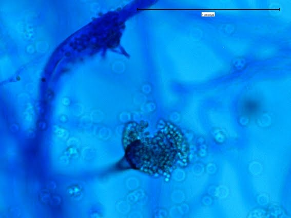 Fun With Microbiology (What's Buggin' You?): Absidia corymbifera ...