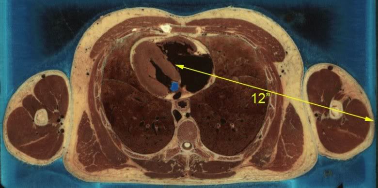 Táctica "VS" Equipo: el tiroteo de Miami/1986