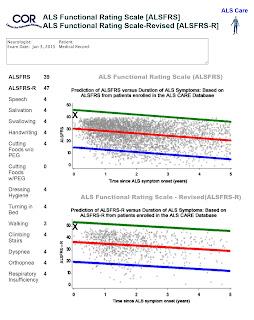 A Life Beyond Measure: Thoughts and Musings on ALS and Life