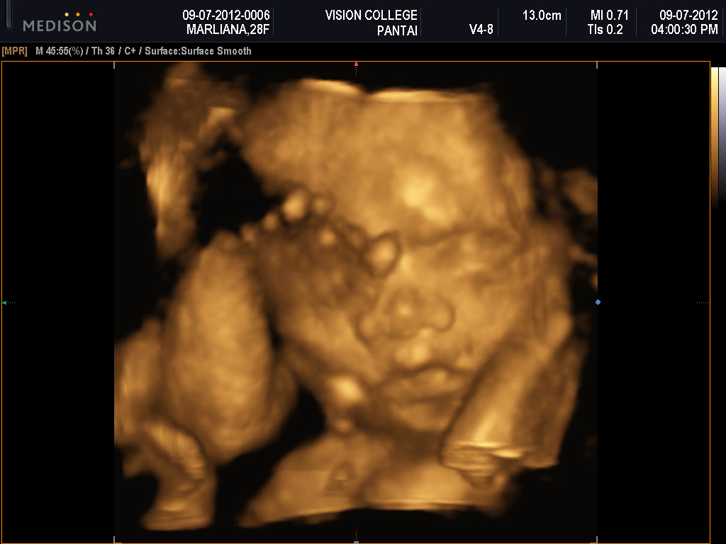 My Simple but Nice Life: 3D/ 4D Scan Baby Scan - 26 Weeks Di Vision College