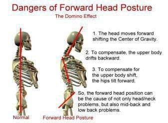 Magna Chiropractic Blog: The Dangers of Forward Head Posture