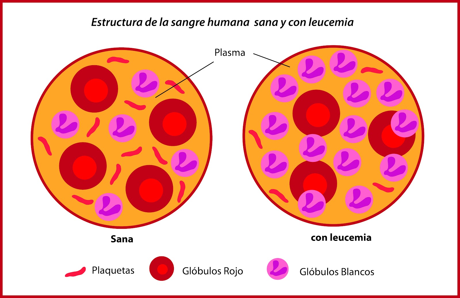 Celulas De Leucemia Vs Celulas Normais