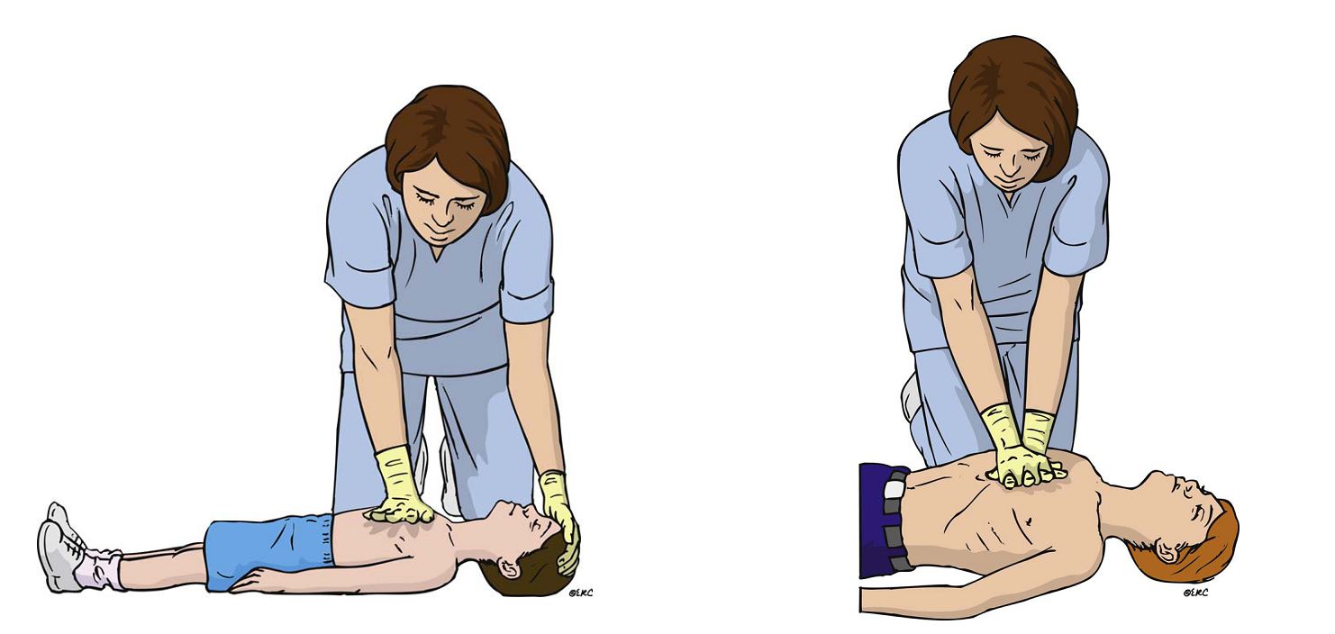 Deporte y Recreación - Chonchi - Chiloé: COMO ----????Reanimación ...