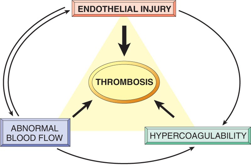 Virchow's triad ~ Medicine Hack