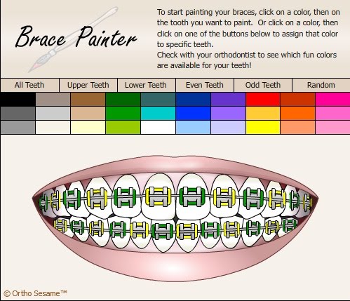 The Dischinger Team Blog: Visualize your new smile with the Brace Painter!