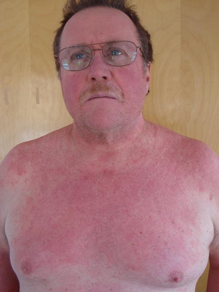 VIRTUAL GRAND ROUNDS IN DERMATOLOGY 2.0