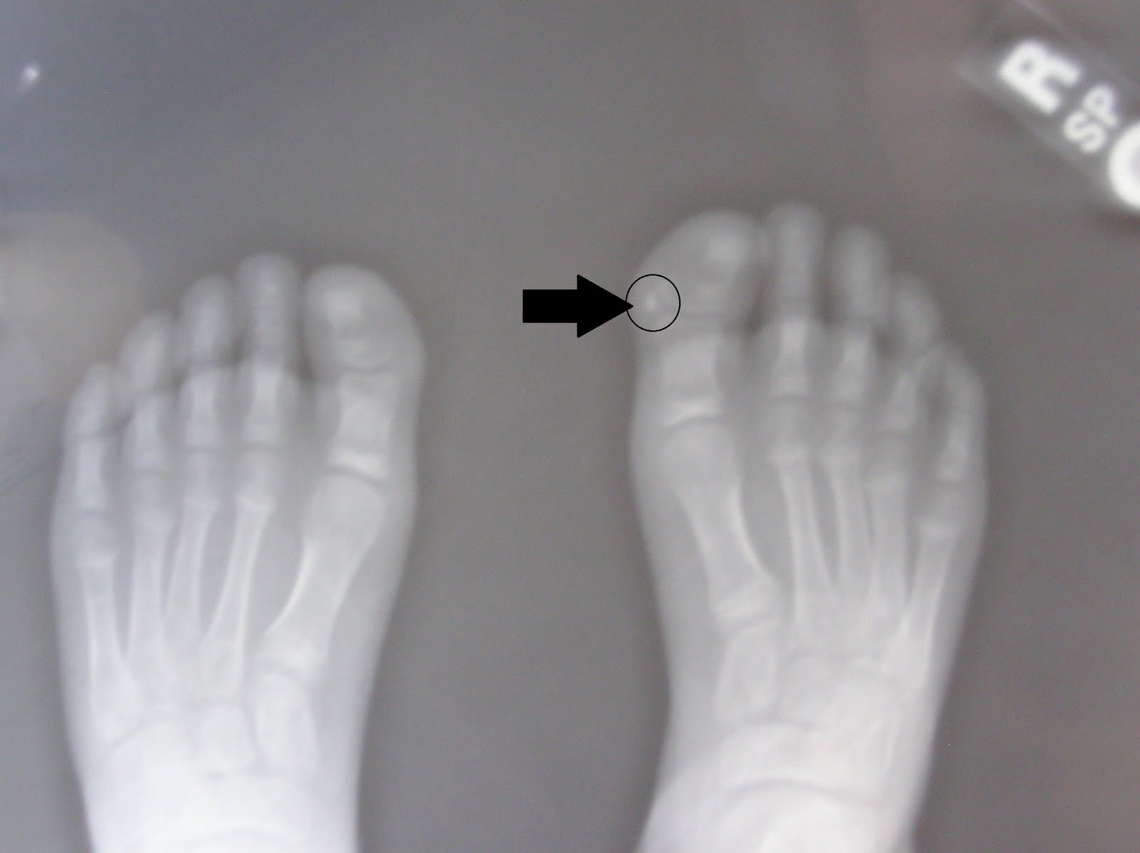 Treasures for Heaven: Big Toe