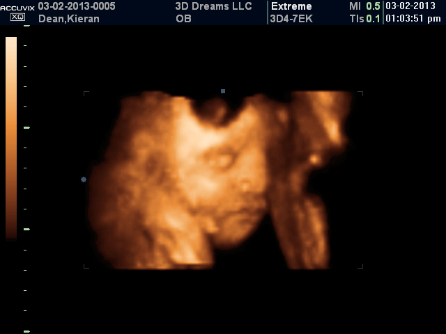 J & K Happily Ever After: 3-D Ultrasound at 31 weeks 4 days
