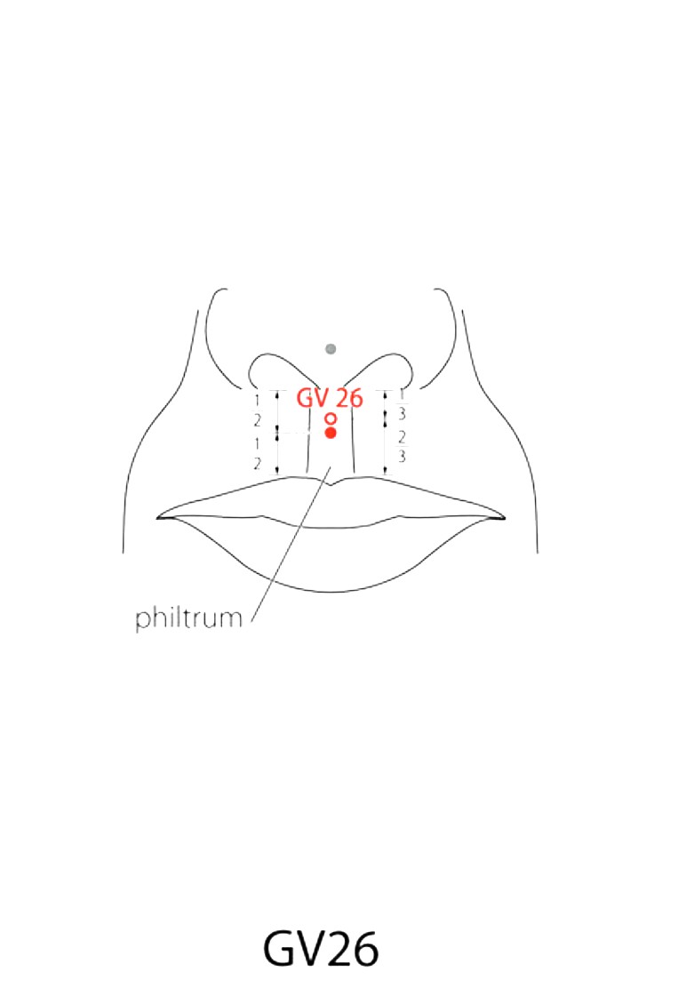 SaroEpic Acupuncture : 2016