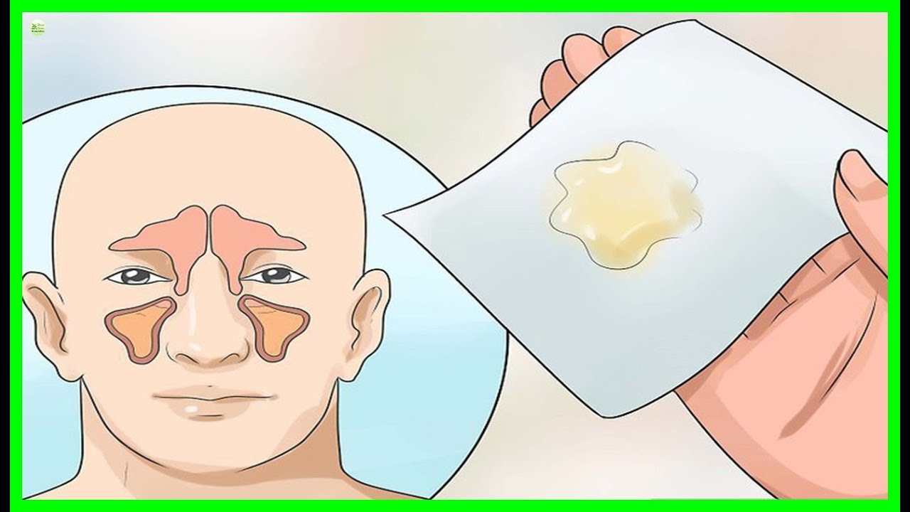 Métodos que te ayudaran a botar el moco y la flema de tu garganta y ...