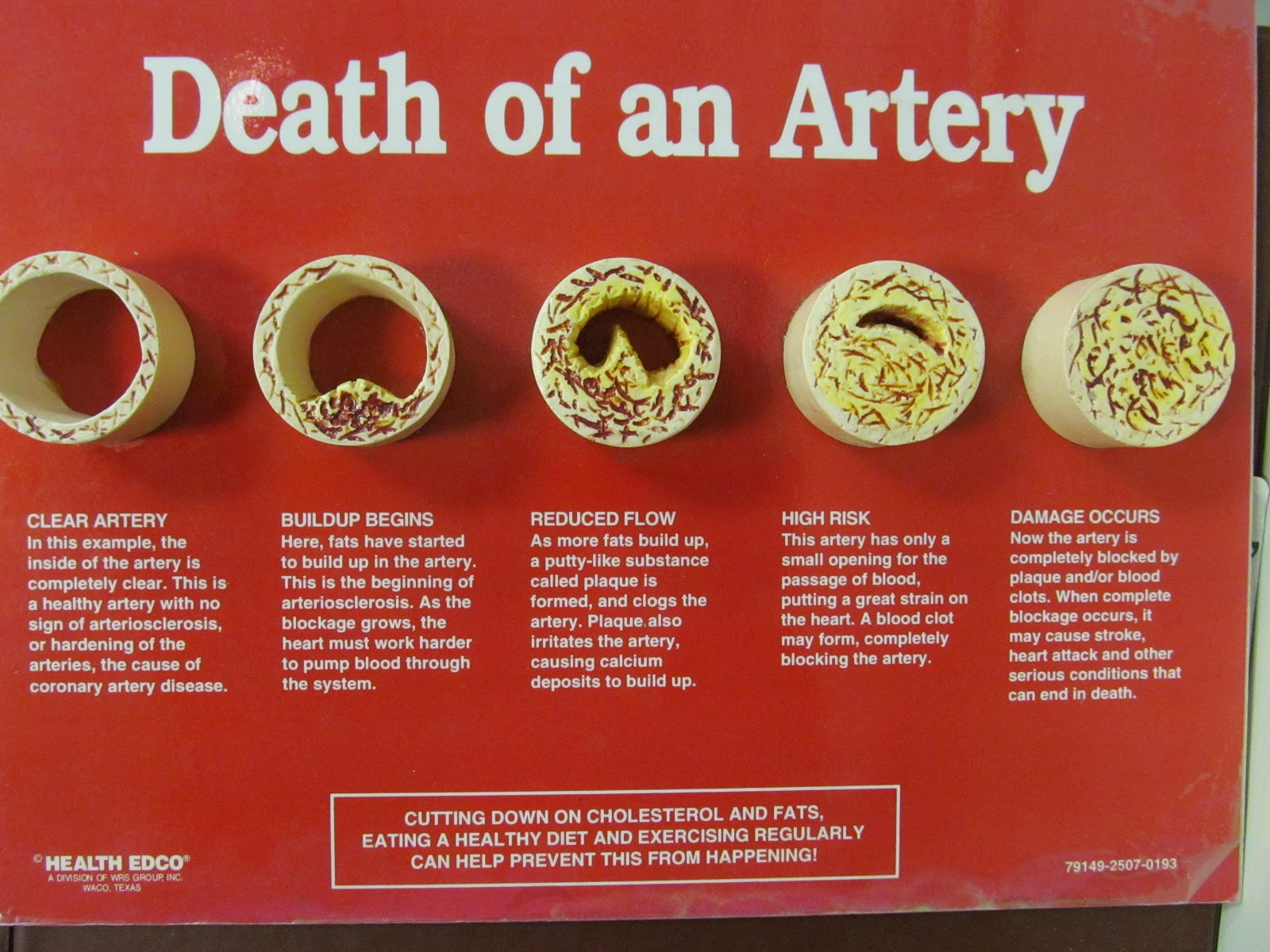 Heart Health Indiana: May 2012