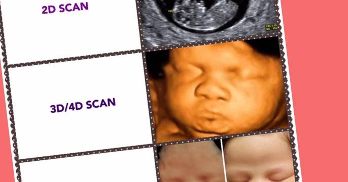 5D 6D SCAN SONOVISION What Is The Difference Between 2D 3D 4D HD 5D 6D 