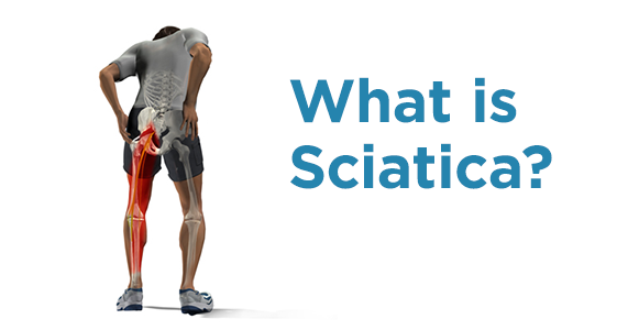 Sciatica treatments: What Is Sciatica?