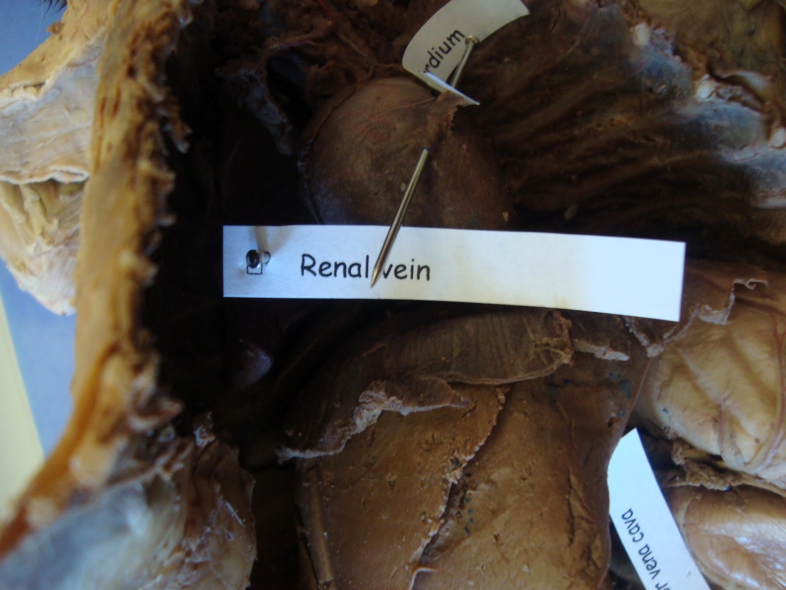 Cat Dissection: Human Anatomy: Cardiovascular System