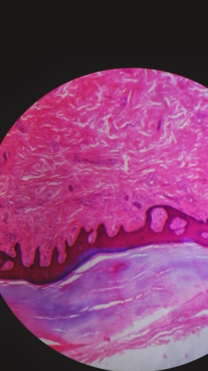Placas de histología : Piel gruesa y fina con sus anexos
