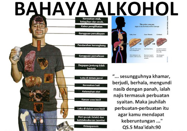 Bahaya Alkohol/Minuman Keras Bagi Kesehatan ~ Kausar Berbagi Pengetahuan