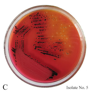 MICROBIOLOGY BLOG FOR STUDENTS (MBLOGSTU): Cultural and Biochemical ...