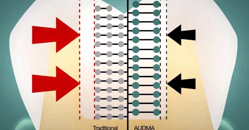 DENTAL MATERIALS: Filtek™ Bulk Fill Posterior utilizes 3M ...