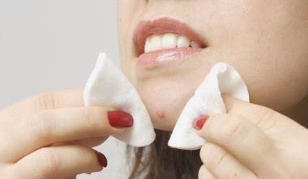 5 Cara Menghilangkan Jerawat Batu di Wajah dengan Cepat dan Alami