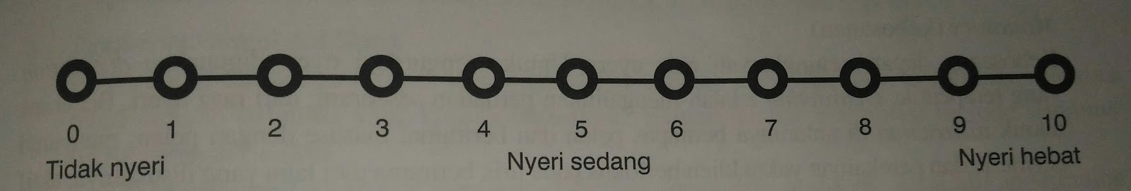 AnakPintar: Bagaimana Cara Mengukur Skala Nyeri
