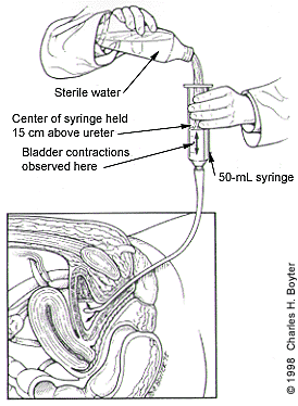 Oklahoma Women's IC & Pelvic Pain Support: Bladder Instill...What?!