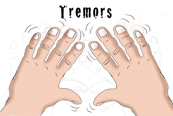 About Health: Tremor