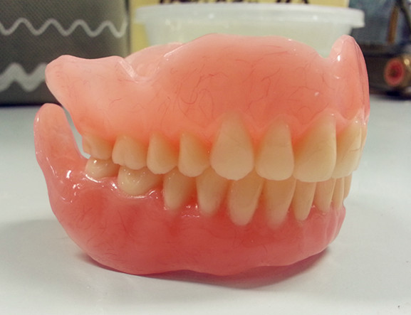 Live. Laugh. Love: The Very First Full Denture