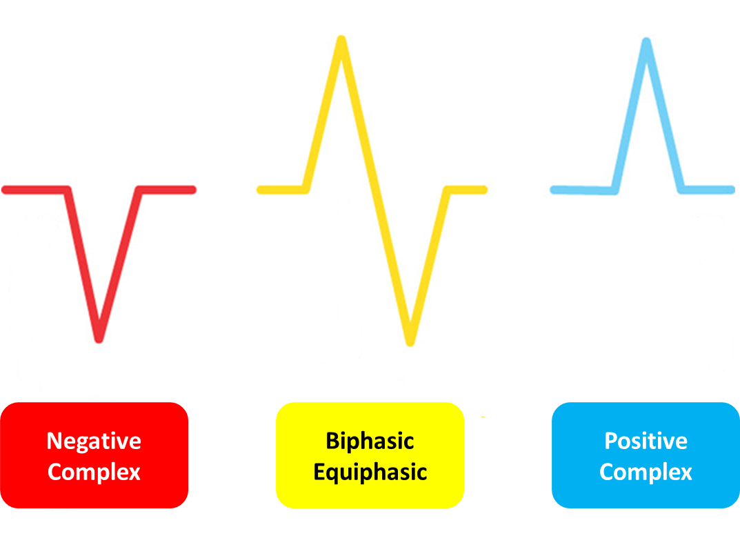 Cardio Rhythms Online: Cardiac Axis