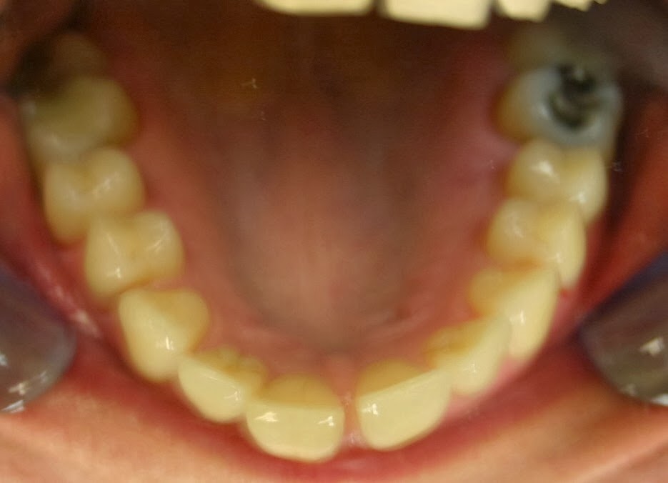 Crescent Dental on Blogspot!