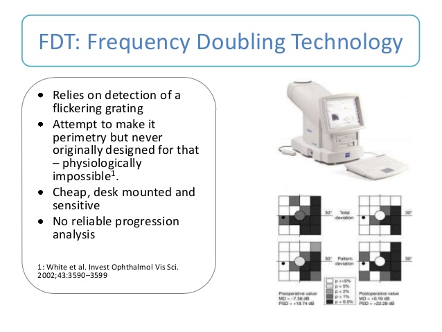 Glaucoma Specialist Blog: The "Glog": October 2016