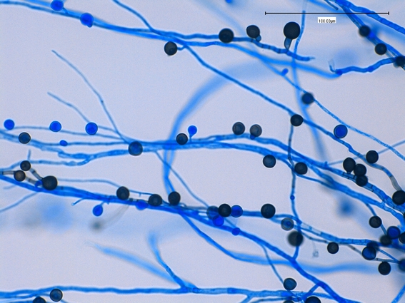 Fun With Microbiology (What's Buggin' You?): Unidentified Mould No. 2 ...