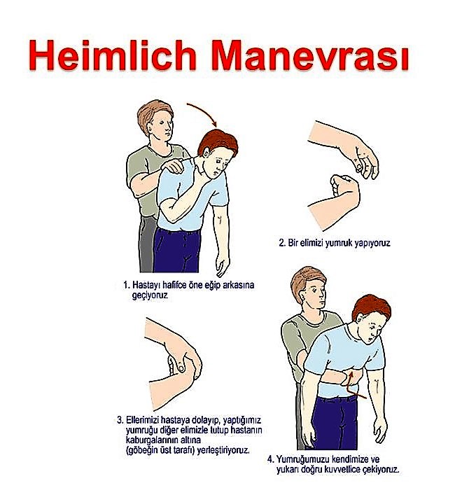 Heimlich manevrası