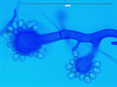 Fun With Microbiology (What's Buggin' You?): Cunninghamella species