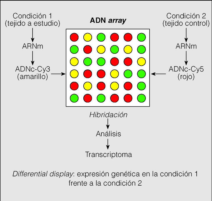 QCHIP HEMO PARA LA DETECCIÓN DE UN TIPO DE LEUCEMIA