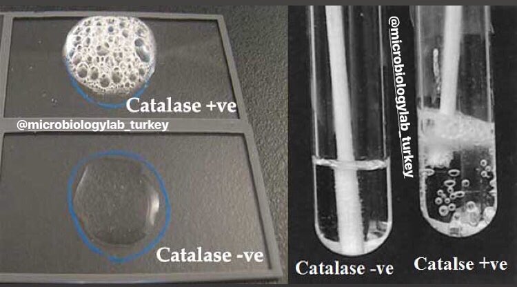 KATALAZ TESTİ - Microbiology Laboratory Turkey