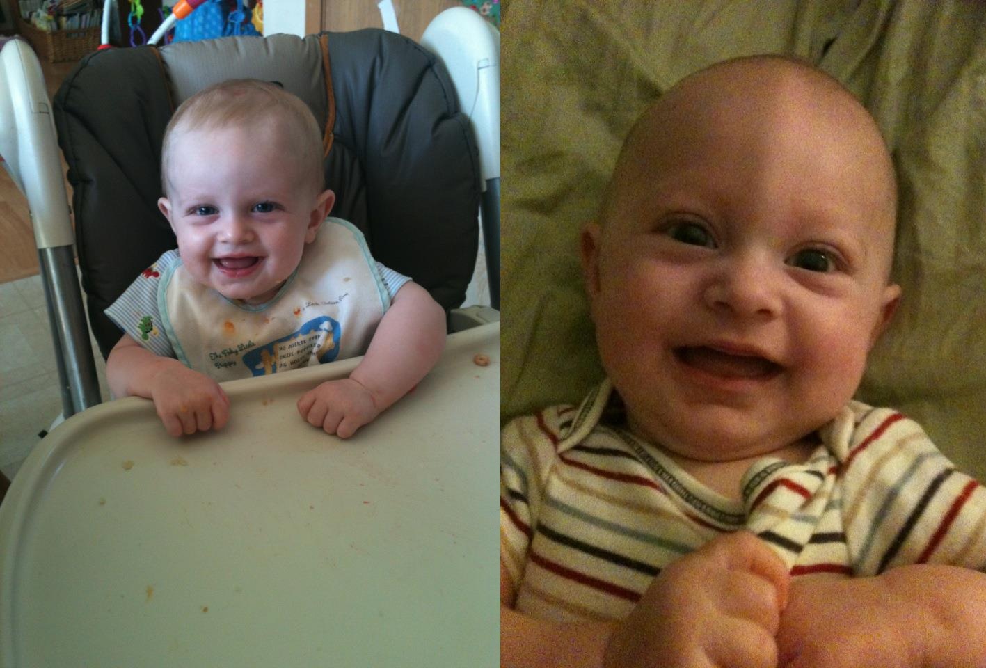 FATTKAW: Metopic Ridge and it is gone...