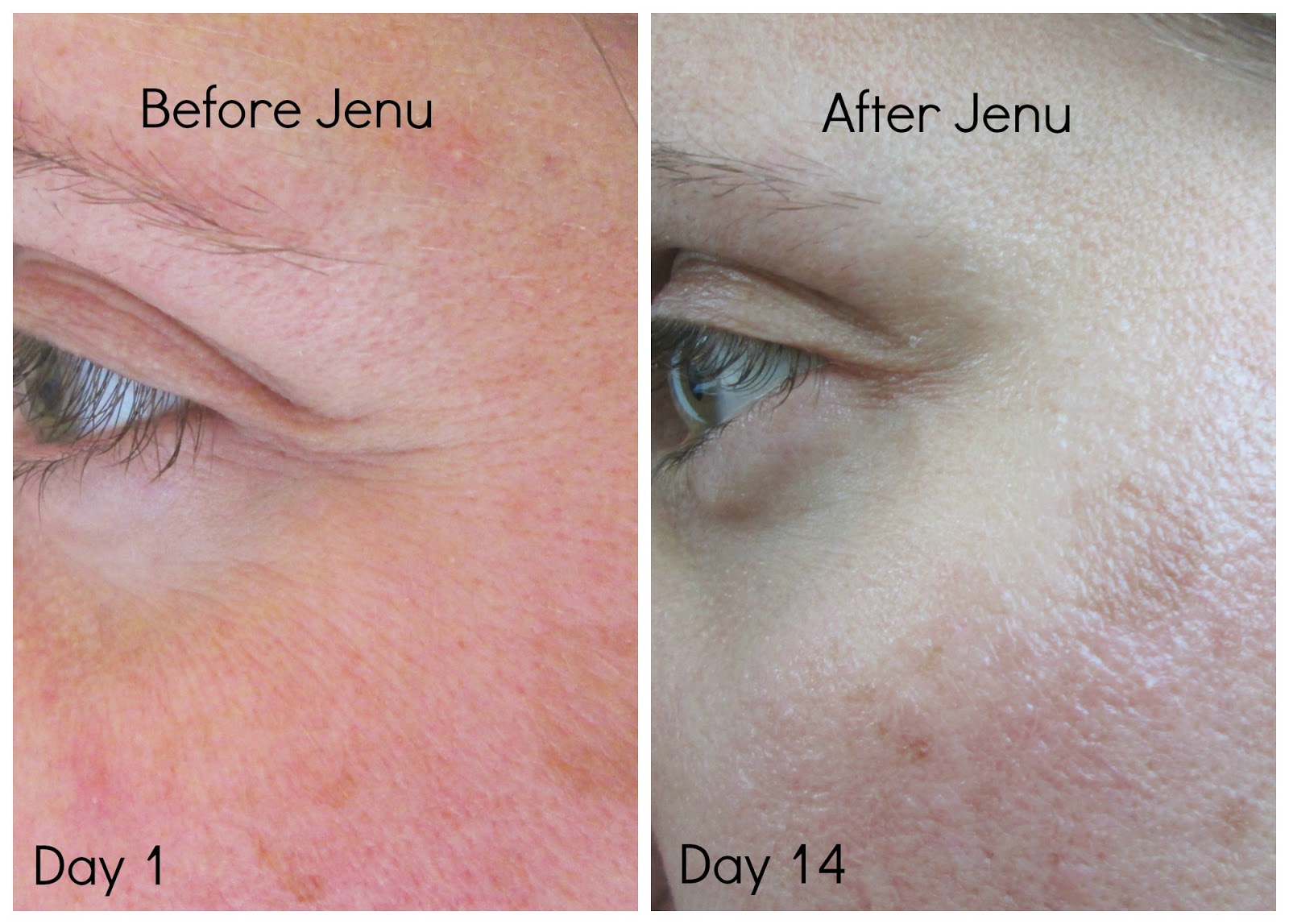 A Revolutionary New Anti-Age Technology-JeNu Review - Outnumbered 3 to 1